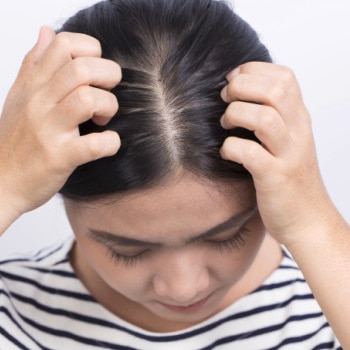 Kenapa Kepala Gatal Tapi Tidak Ada Kutu dan Ketombe? Cek Penjelasan Berikut Ini! | CLEAR