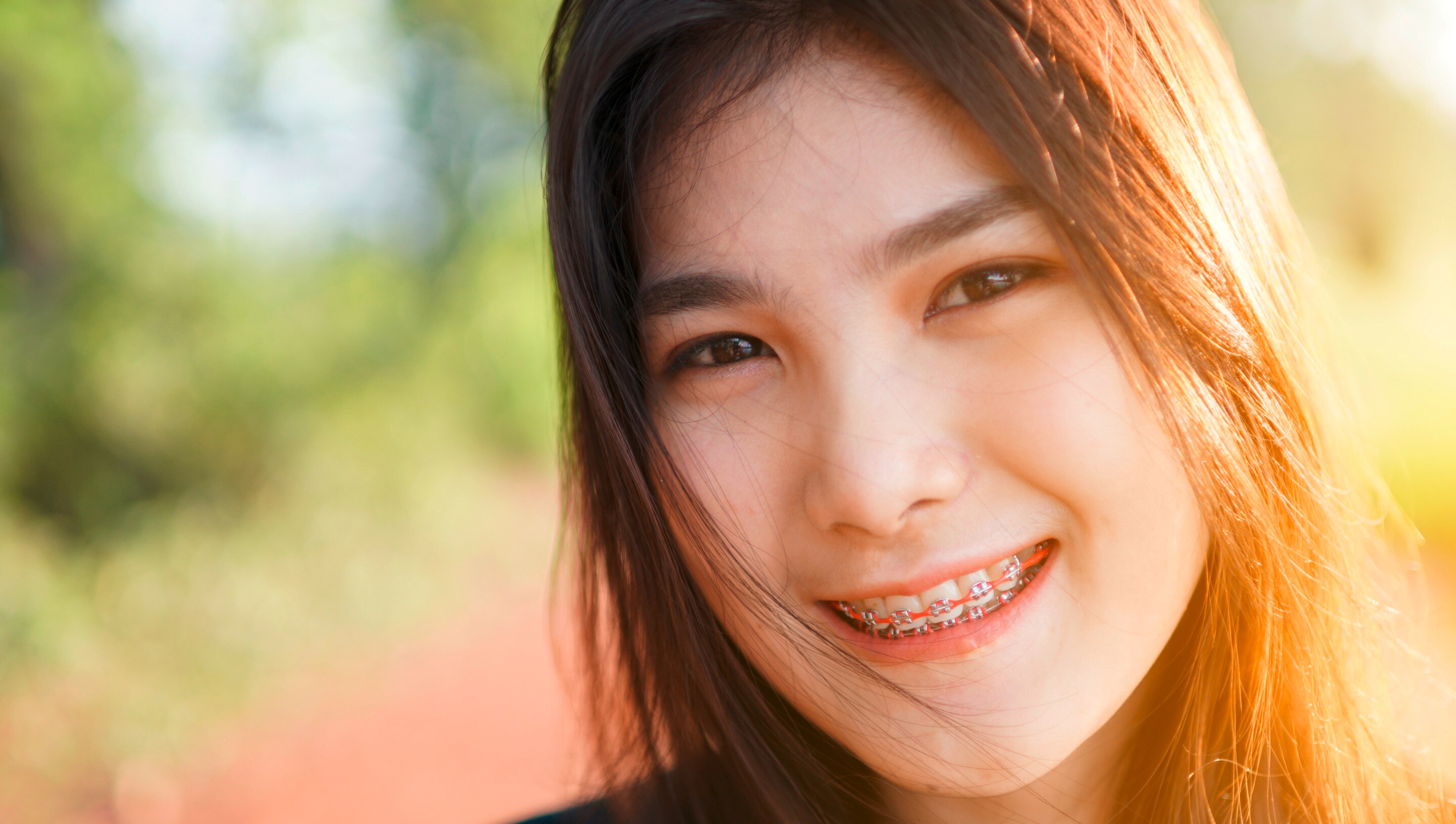 Different Types of Dental Braces and How They Work | AllThingsBeauty