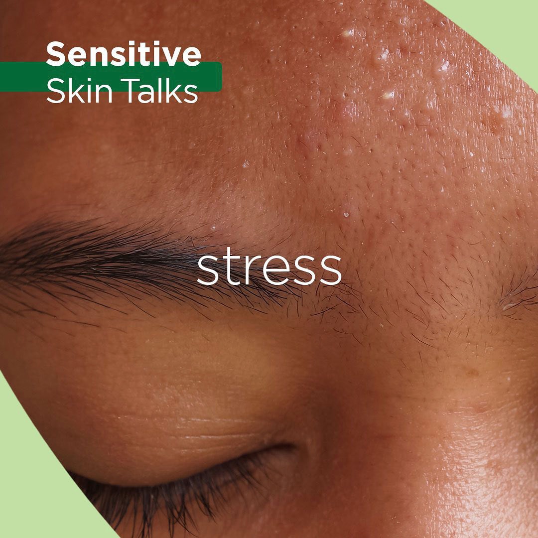 How does stress affect my skin | Simple® Skincare